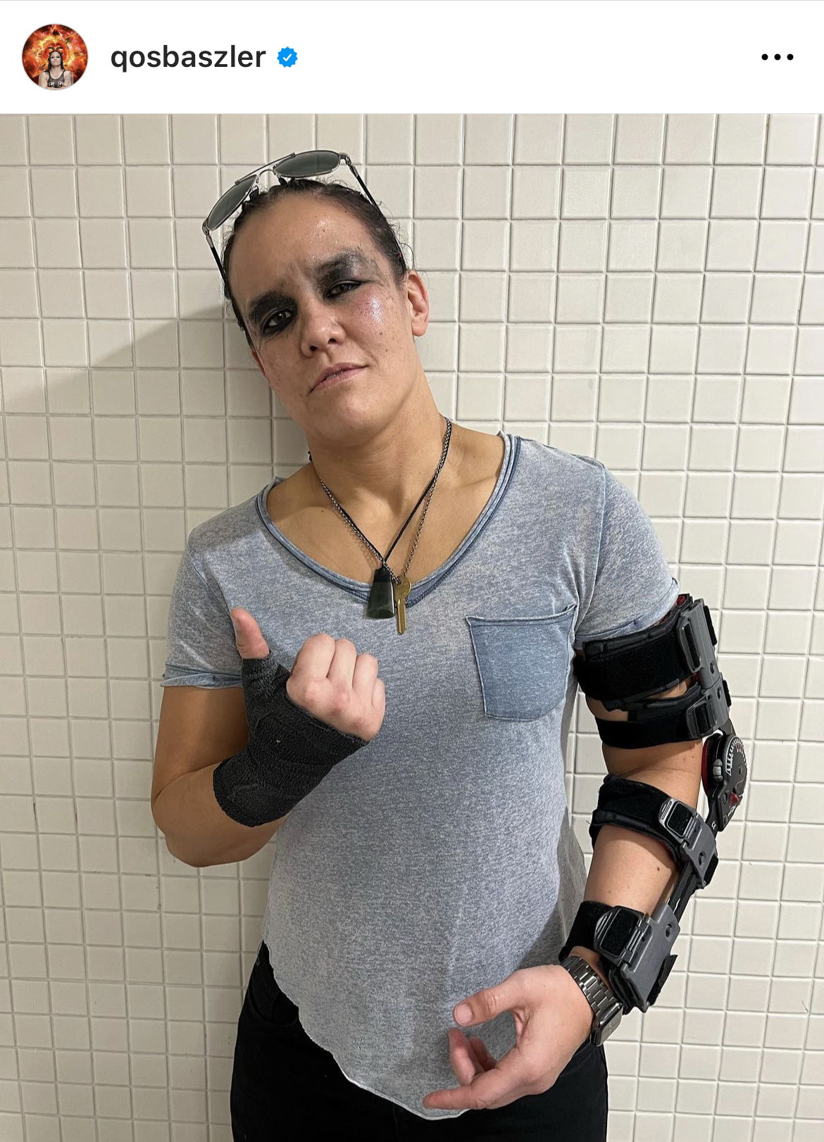 Wwe Star Reveals Injuries After Summerslam 2023 Wrestletalk